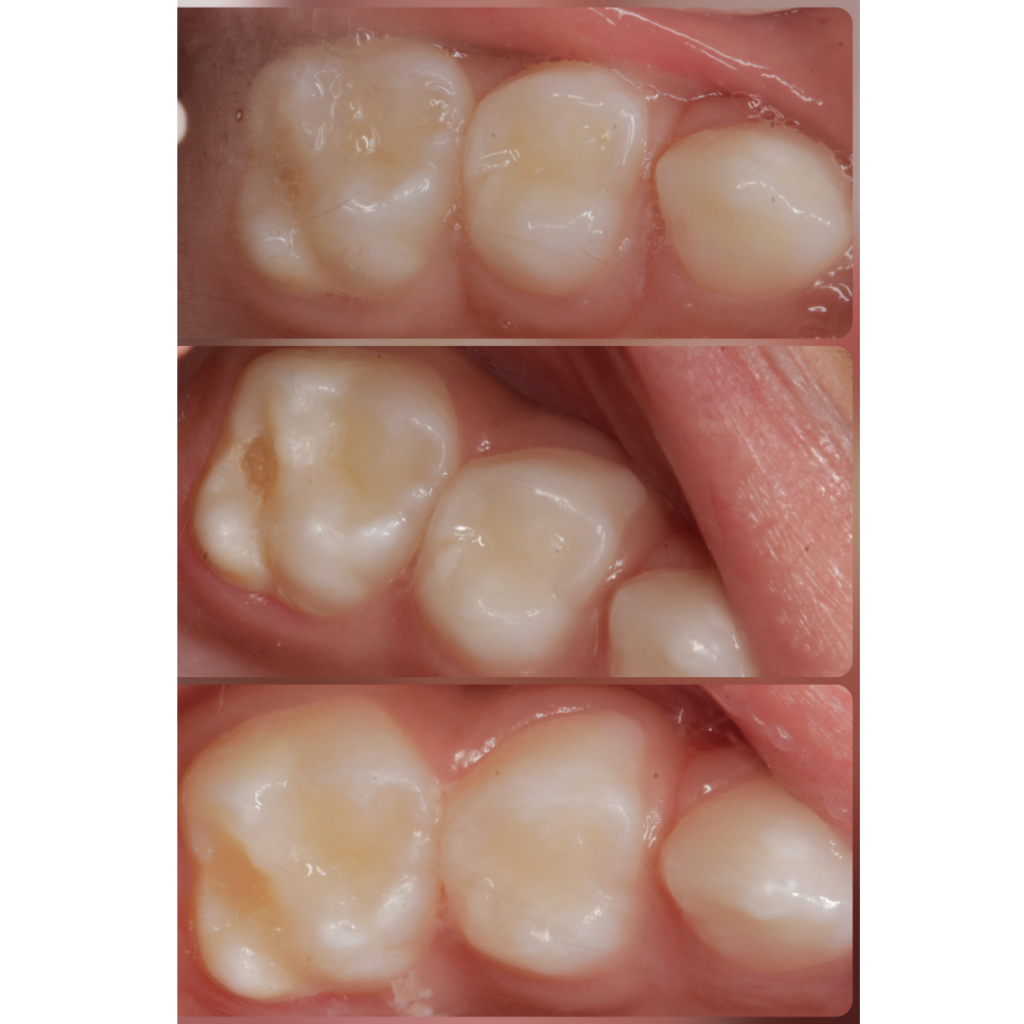 Images | Vanilla Smiles Dental Clinic